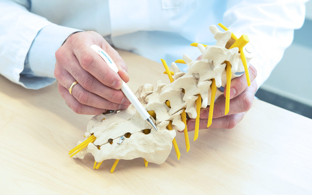 Iliosakralgelenk-Syndrom (ISG-Syndrom) | PD Dr. Burkhardt (Hirslanden)